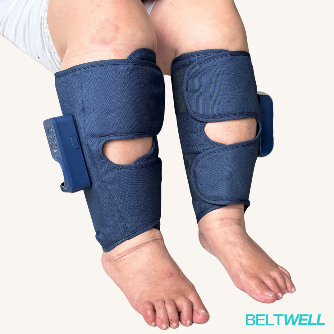 Compression Wraps For Big Swollen Legs That Are Easy To Put On — Beltwell