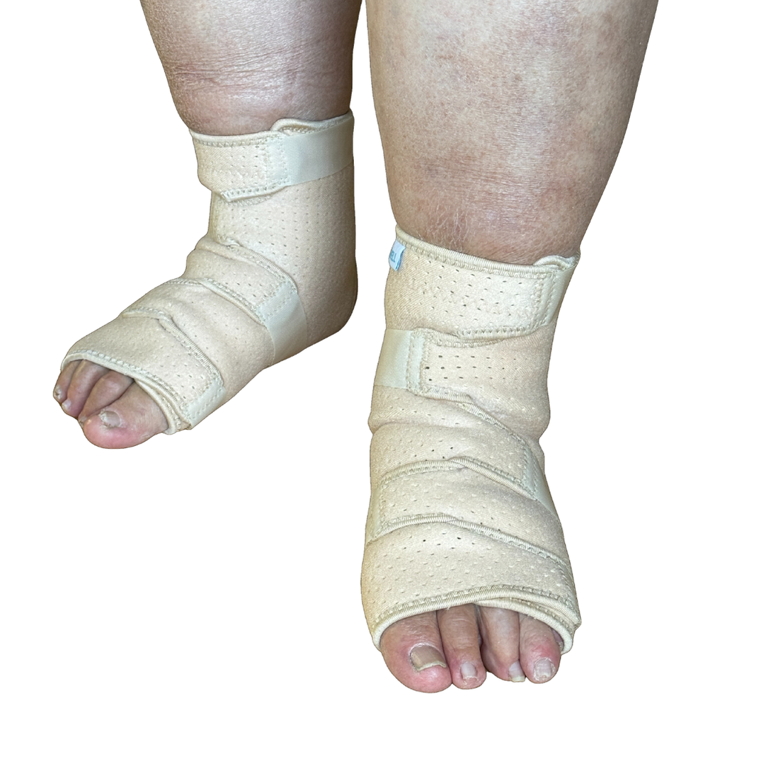 Compression Wraps For Big Swollen Legs That Are Easy To Put On — Beltwell