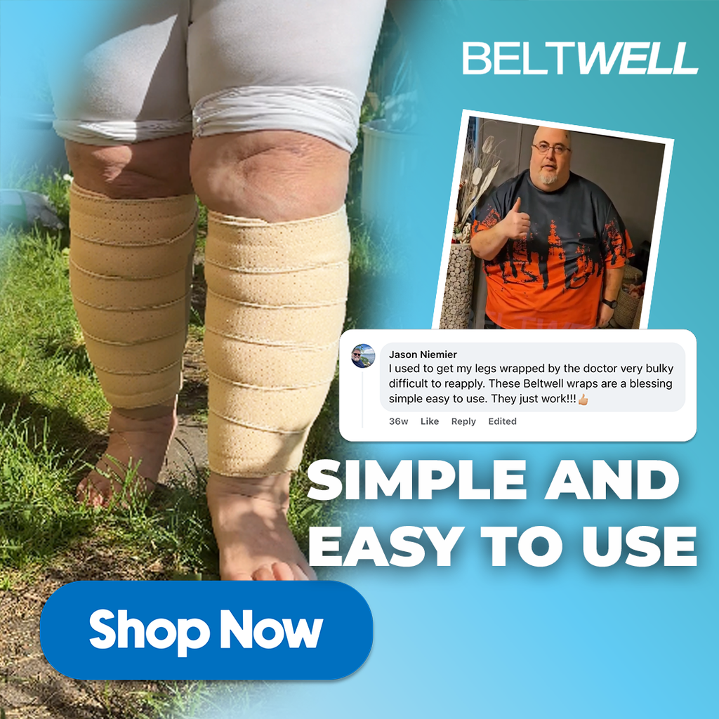Beltwell® - The Calf Compression Wraps For Big Swollen Calves — Beltwell